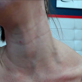 femaleneckveins - femaleneckveins