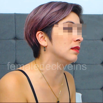 femaleneckveins - femaleneckveins